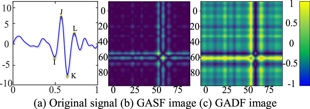 Heart rate detection of ballistocardiogram based on improved DAE and template matching method ...