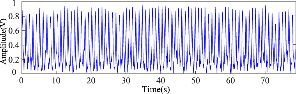 Heart rate detection of ballistocardiogram based on improved DAE and template matching method ...
