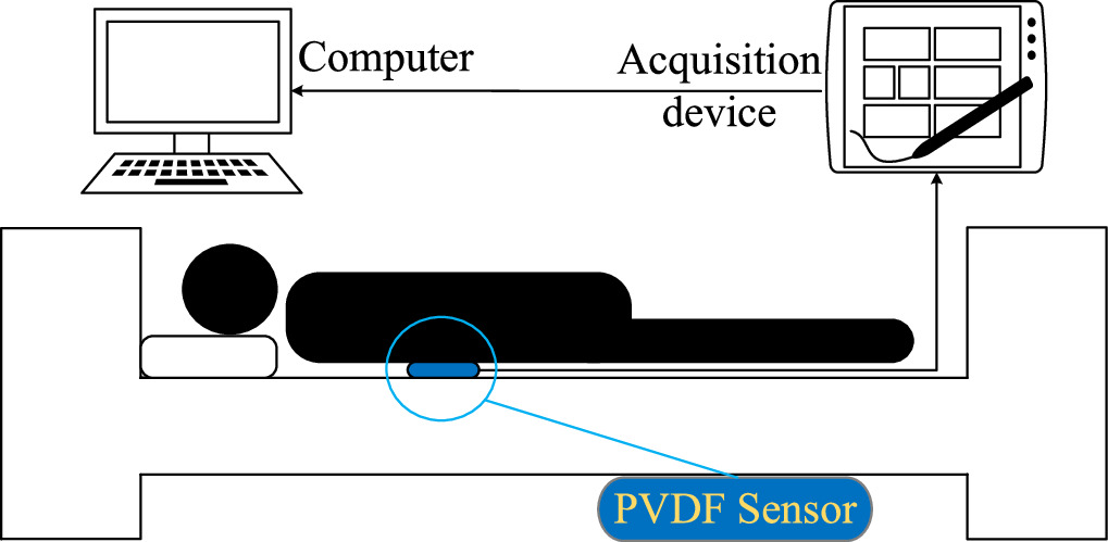 Heart rate detection of ballistocardiogram based on improved DAE and template matching method ...
