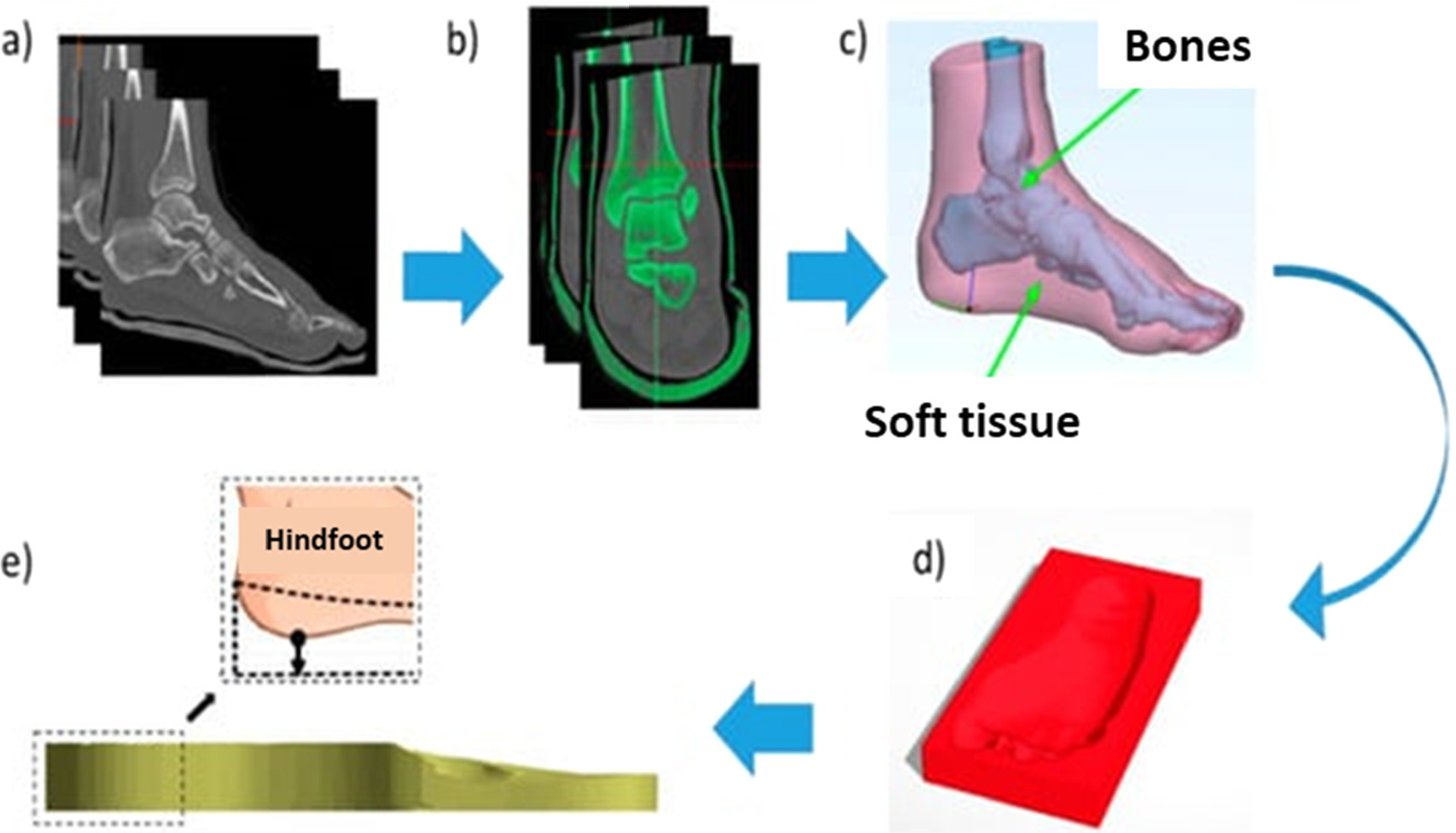 Finite element modeling of diabetic foot: a state-of-the-art review ...