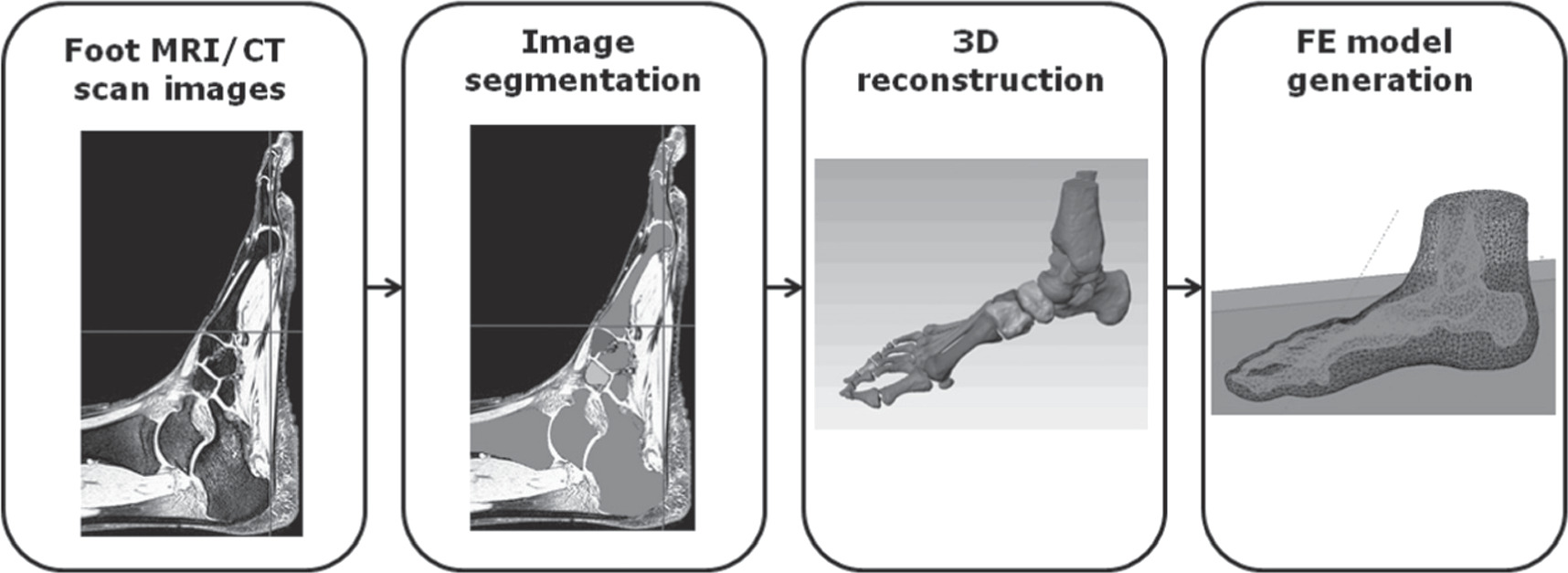 Finite element modeling of diabetic foot: a state-of-the-art review ...