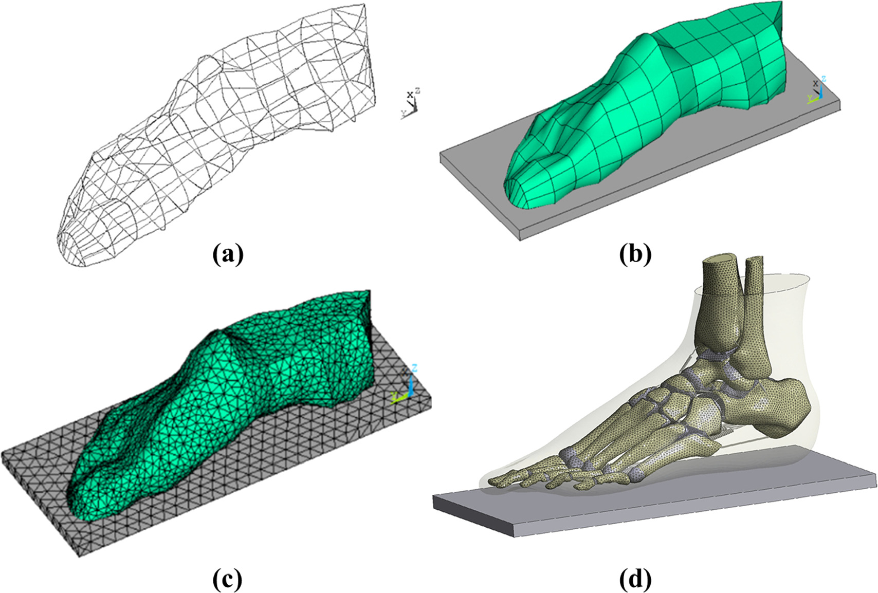 Finite element modeling of diabetic foot: a state-of-the-art review - IOPscience