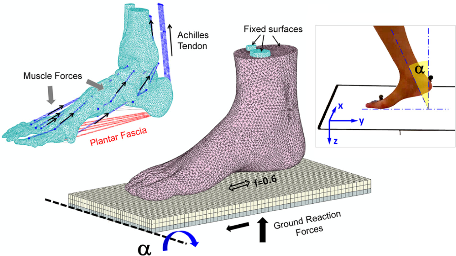 Finite element modeling of diabetic foot: a state-of-the-art review ...
