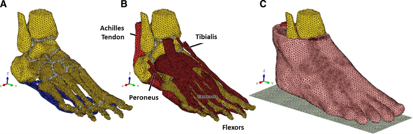 Finite element modeling of diabetic foot: a state-of-the-art review ...