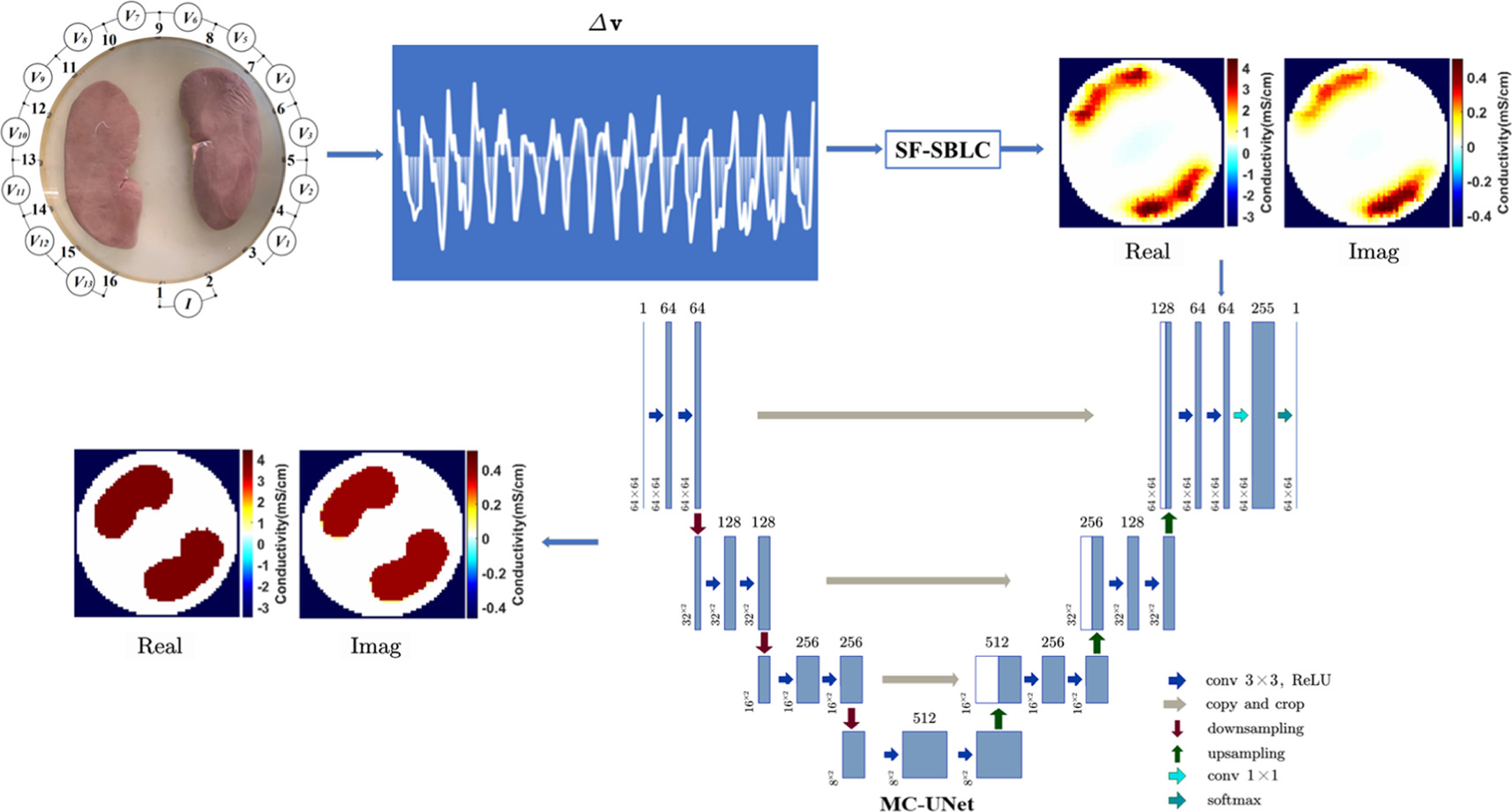 Complex-valued multi-frequency electrical impedance tomography based on deep neural networks ...