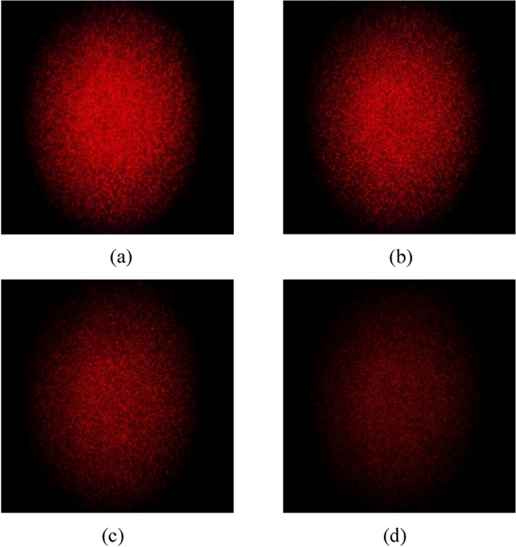 Learning-assisted specklegram analysis for recognition of simultaneous ...