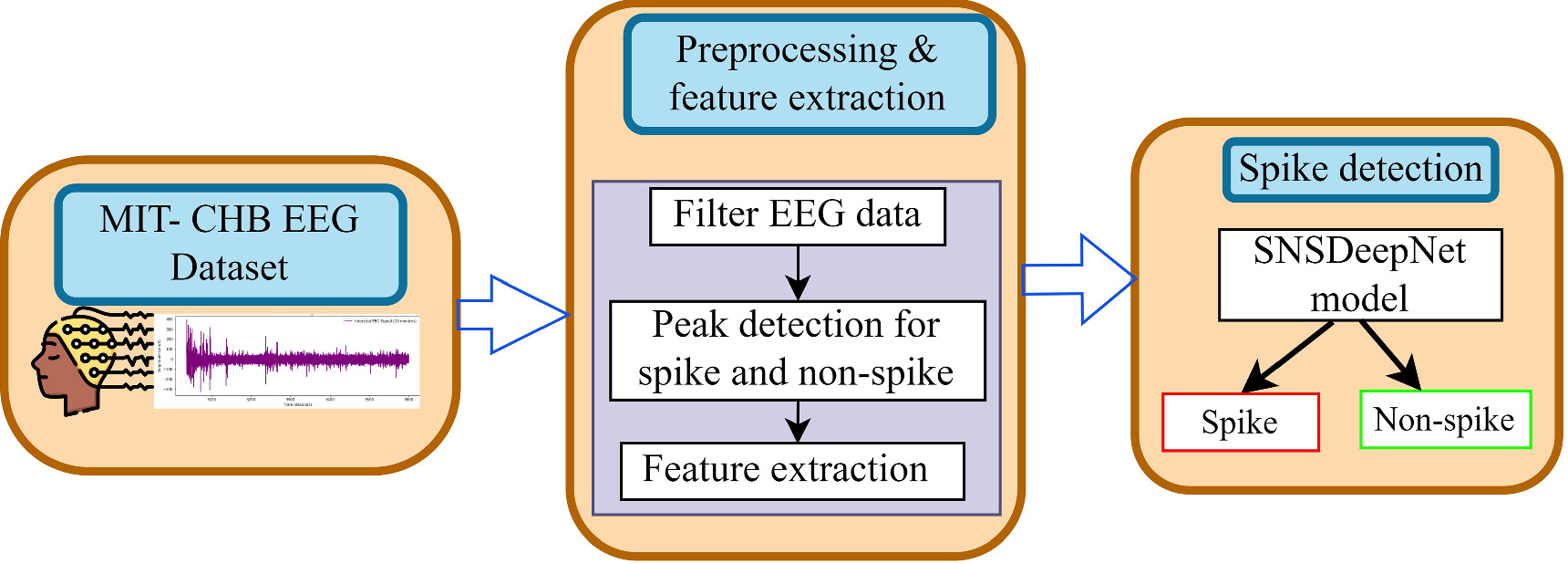 SNSDeepNet: spike and non-spike detection in epilepsy - IOPscience