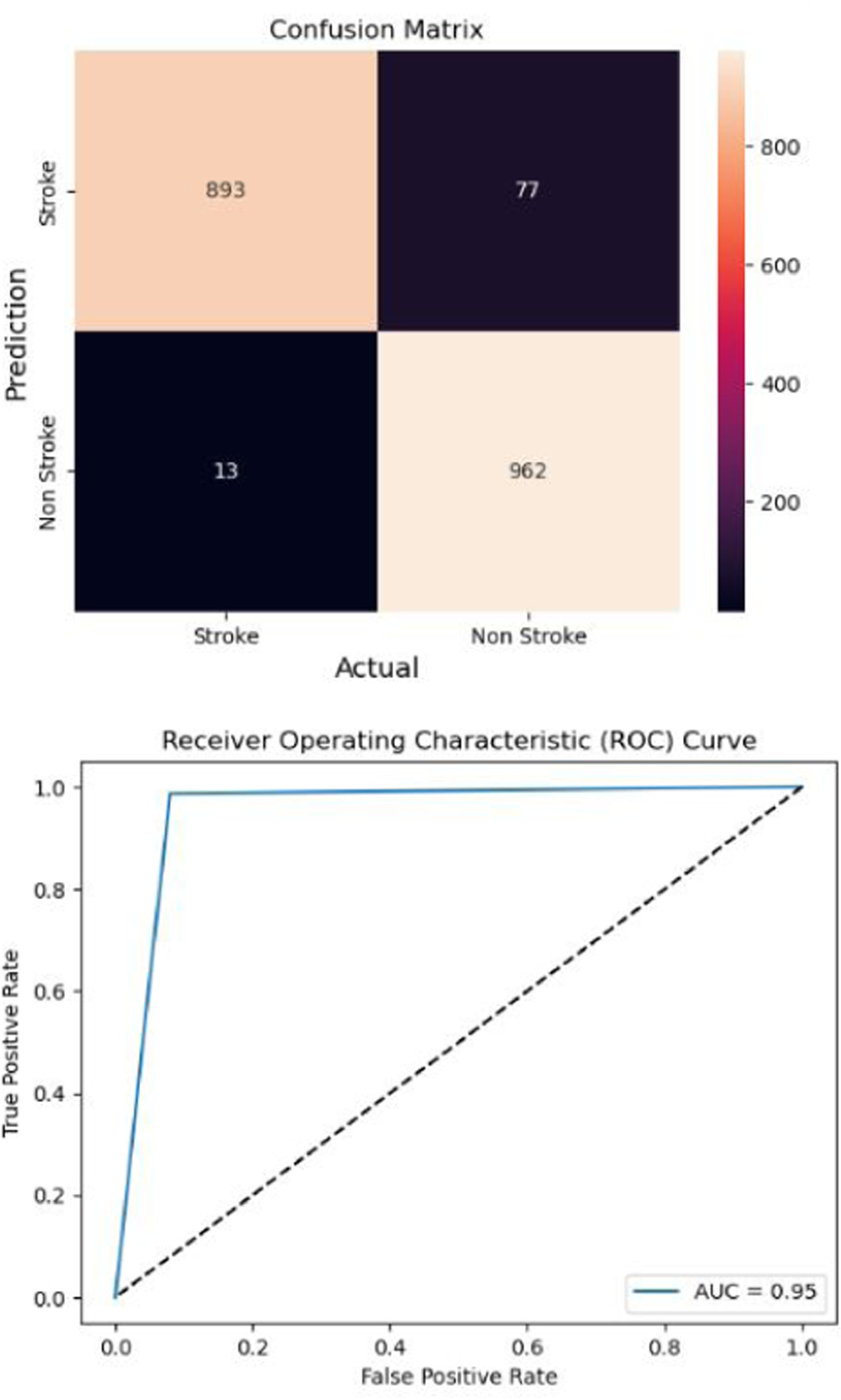 Robust classification model for identifying stroke patients utilising a ...
