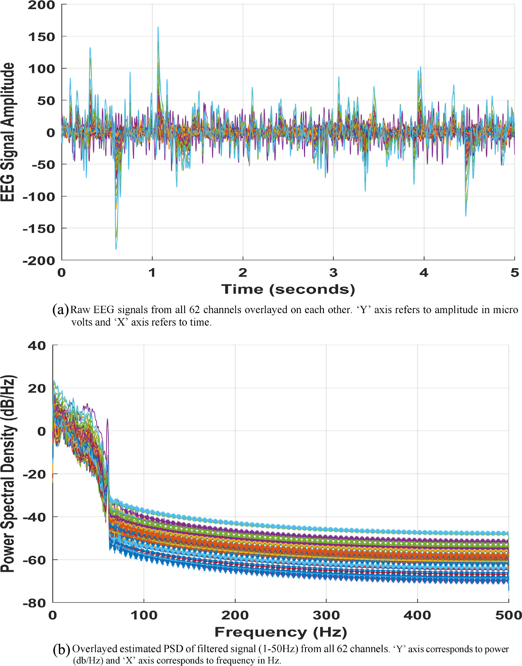Speech imagery decoding from electroencephalography signals using an amalgamation of ...