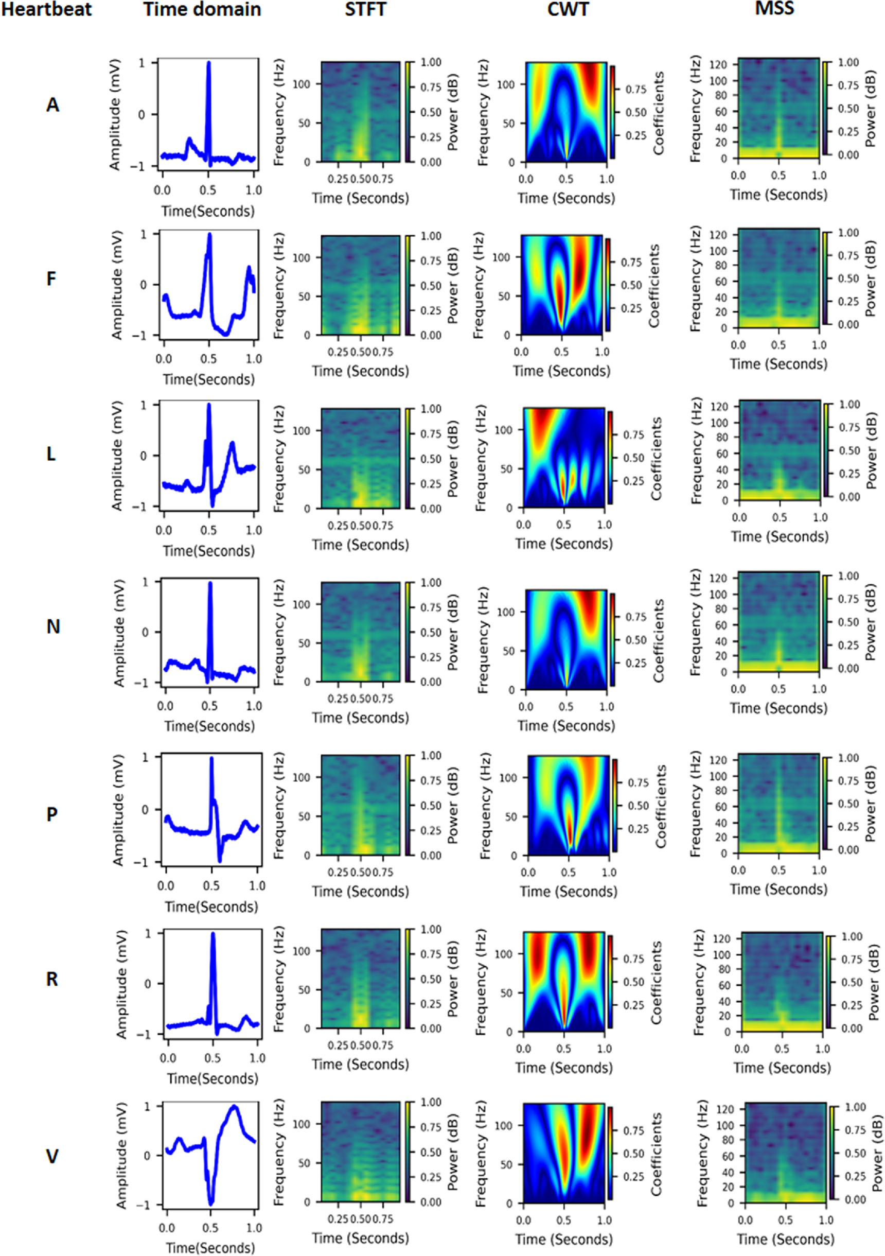 A vision transformer framework for arrhythmia classification with ...