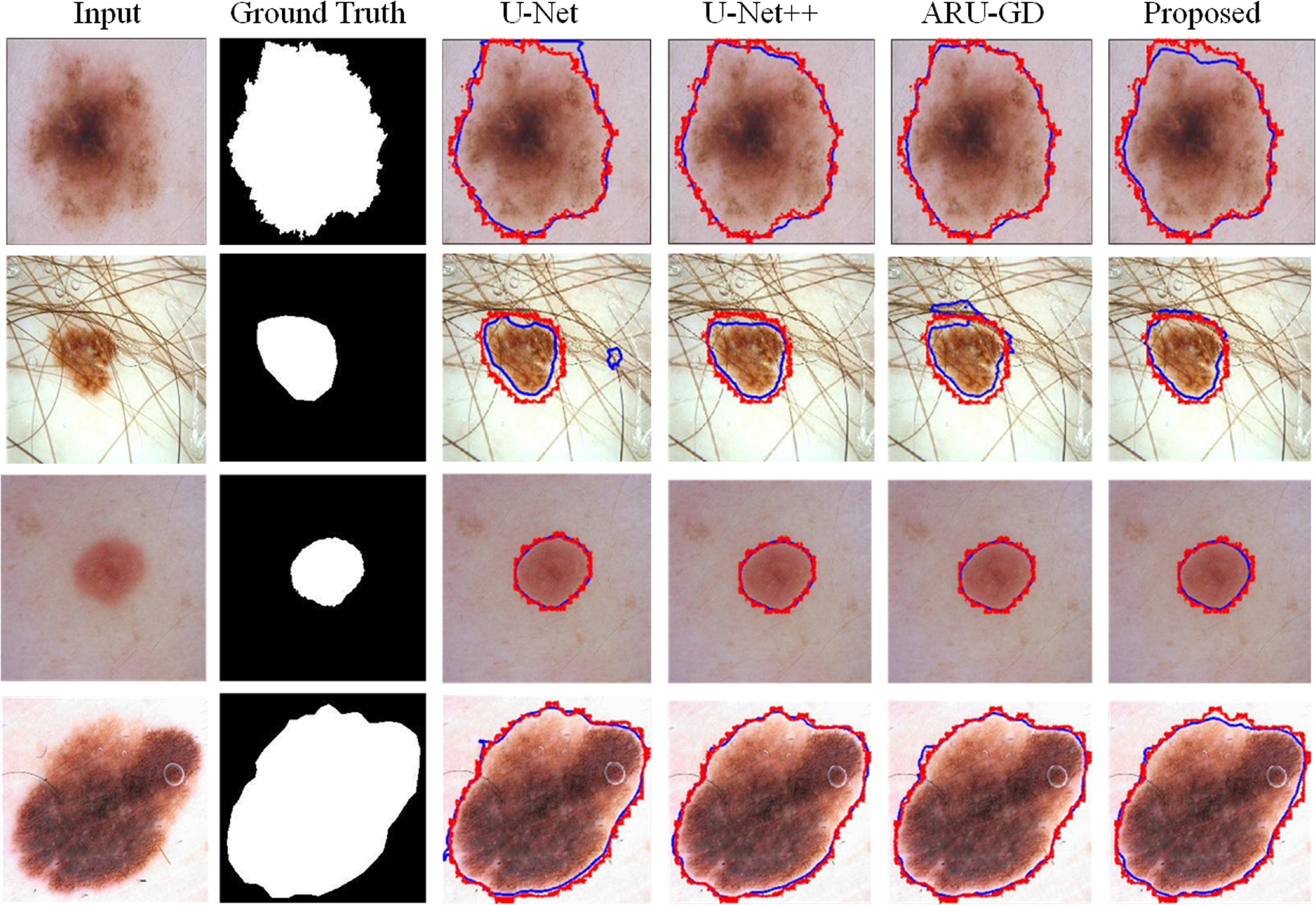 FM-net: focal modulation-based network for accurate skin lesion ...
