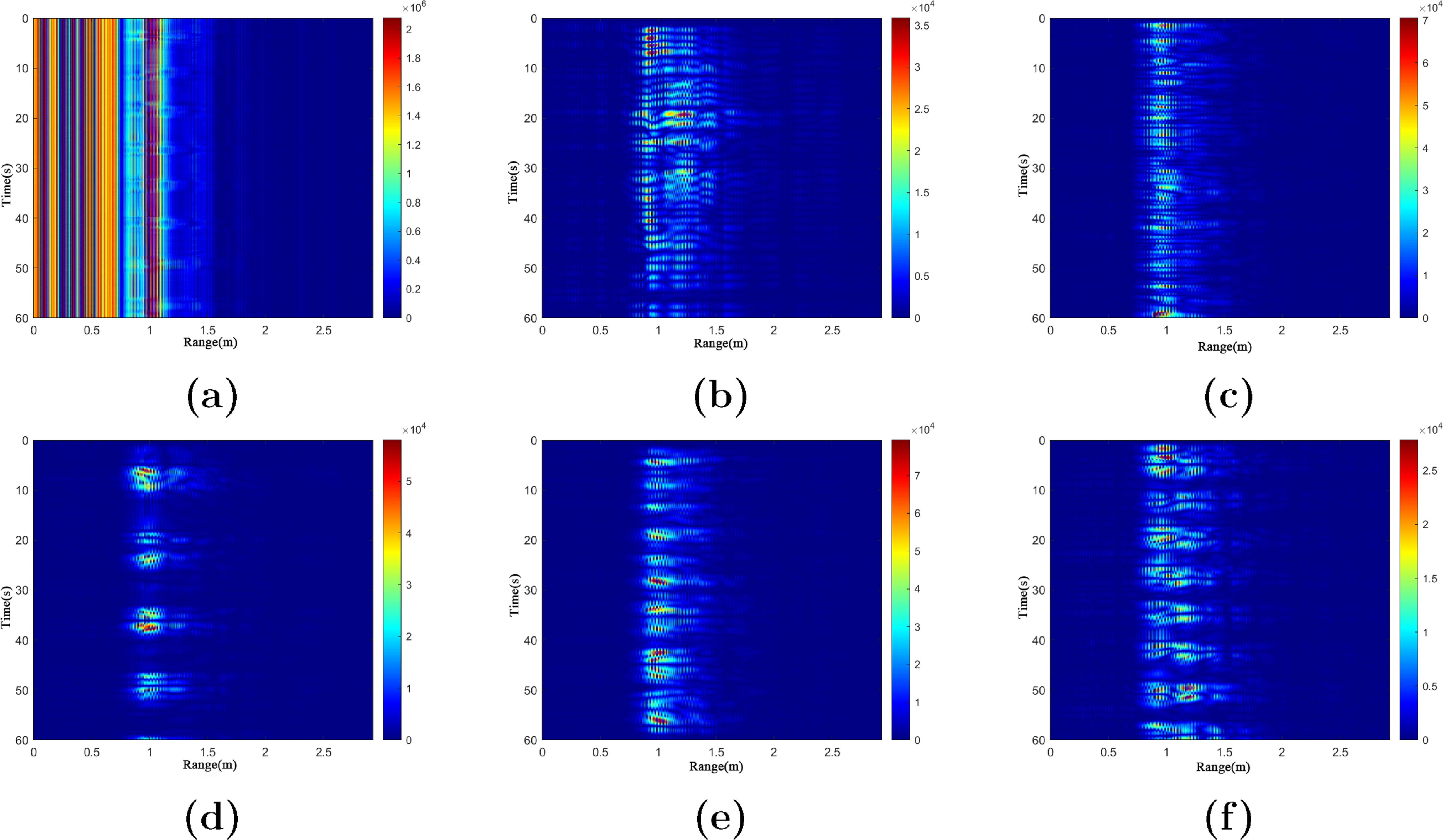 Radar-based respiratory pattern recognition method using stacking-ELCA ...