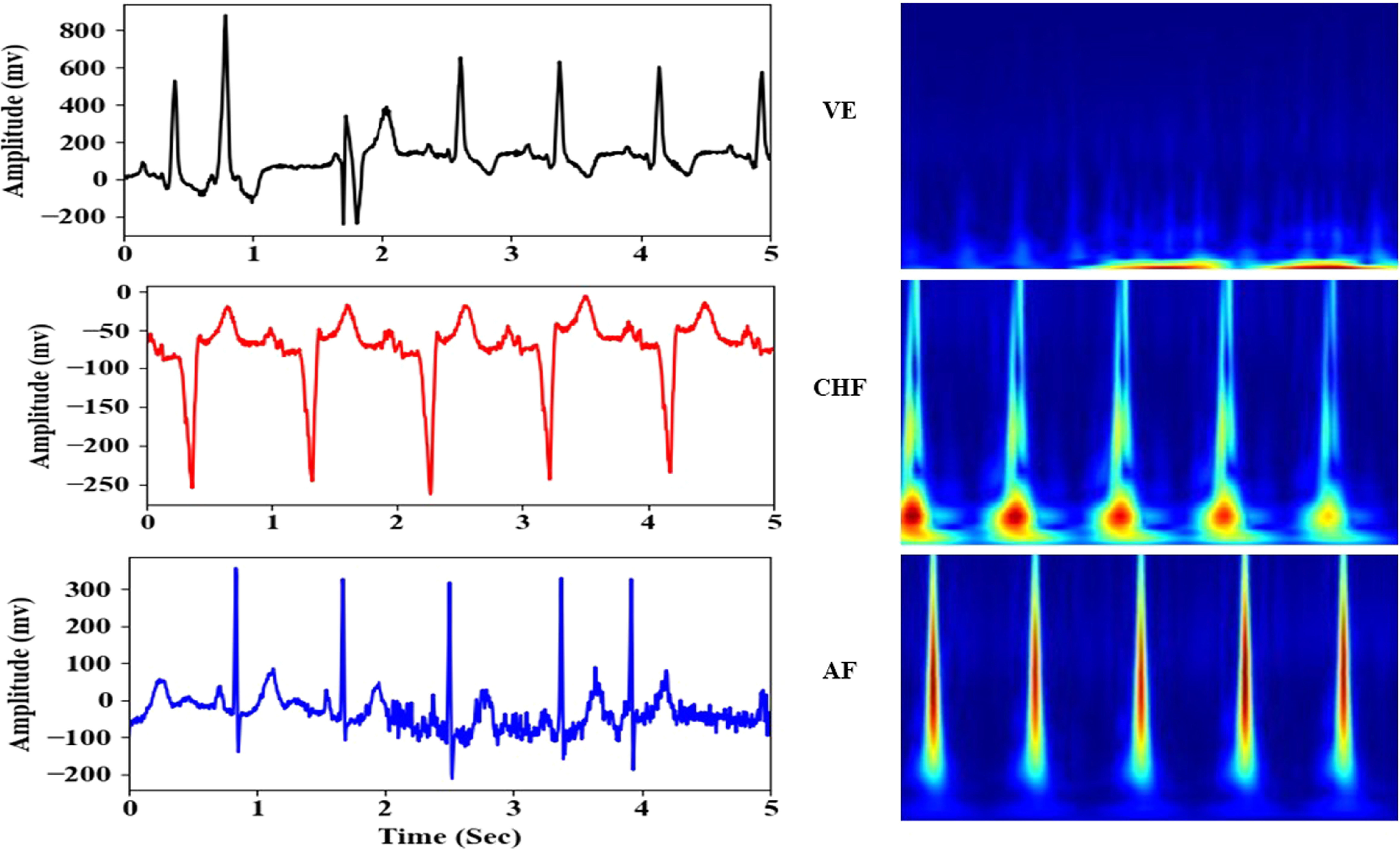Arrhythmias detection using ECG with deep learning and superlet ...