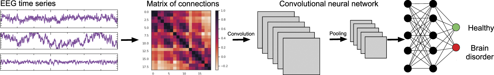 EEG functional connectivity and deep learning for automatic diagnosis ...