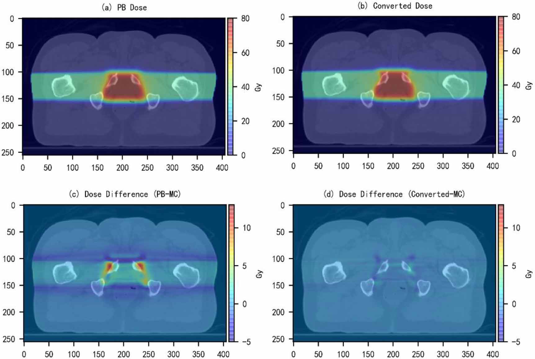 Improving proton dose calculation accuracy by using deep learning ...