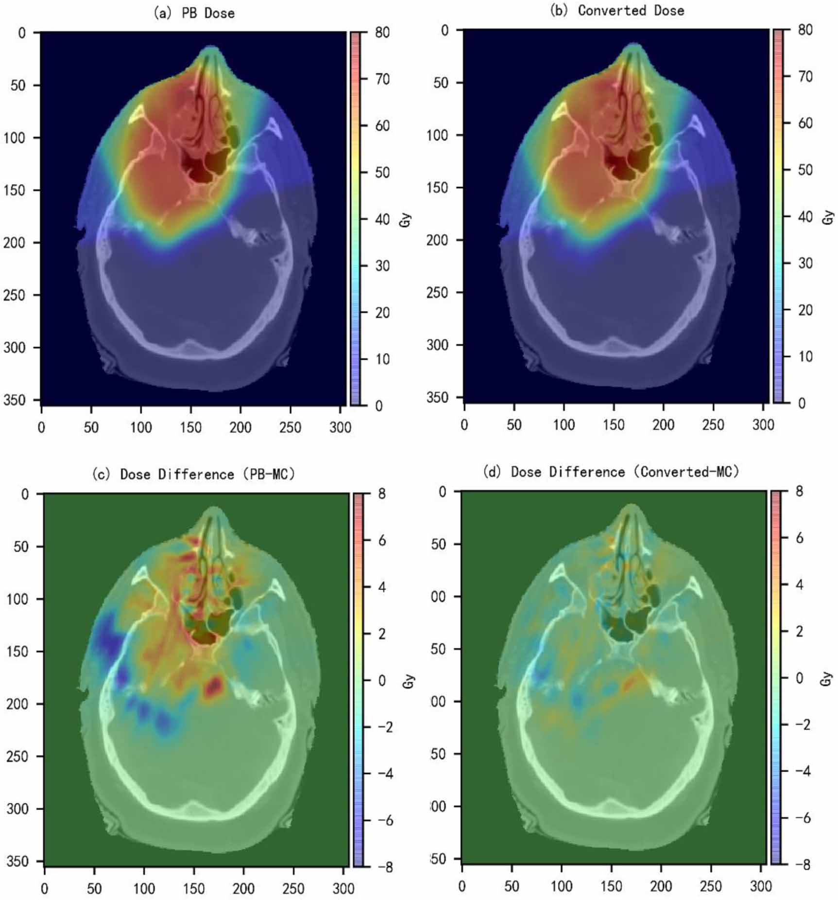 Improving proton dose calculation accuracy by using deep learning ...