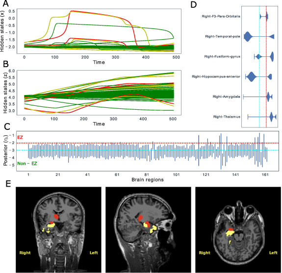 Fully Bayesian estimation of virtual brain parameters with self-tuning Hamiltonian Monte Carlo ...
