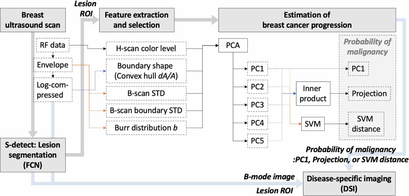 Improving breast cancer diagnosis by incorporating raw ultrasound ...