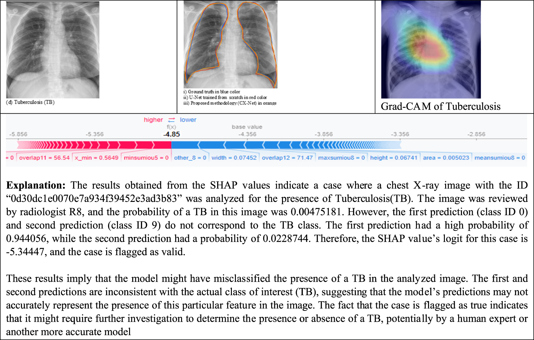 CX-Net: an efficient ensemble semantic deep neural network for ROI ...