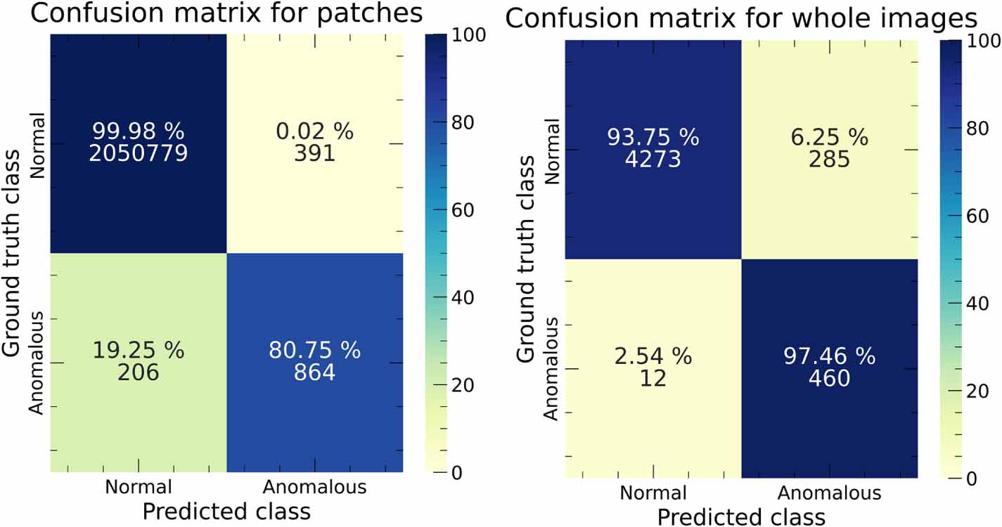 Automated visual inspection of CMS HGCAL silicon sensor surface using ...