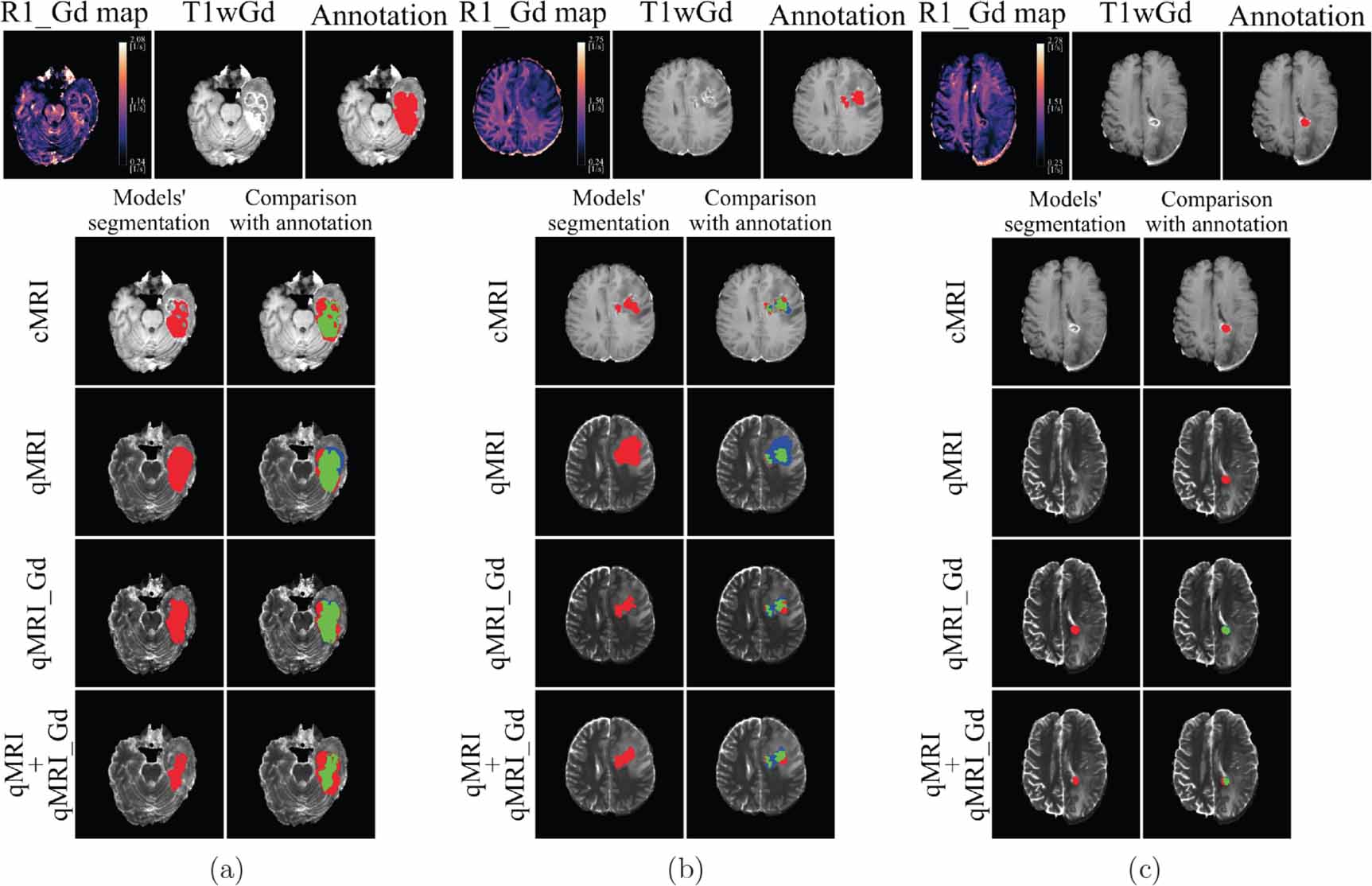 Deep learning-based detection and identification of brain tumor ...