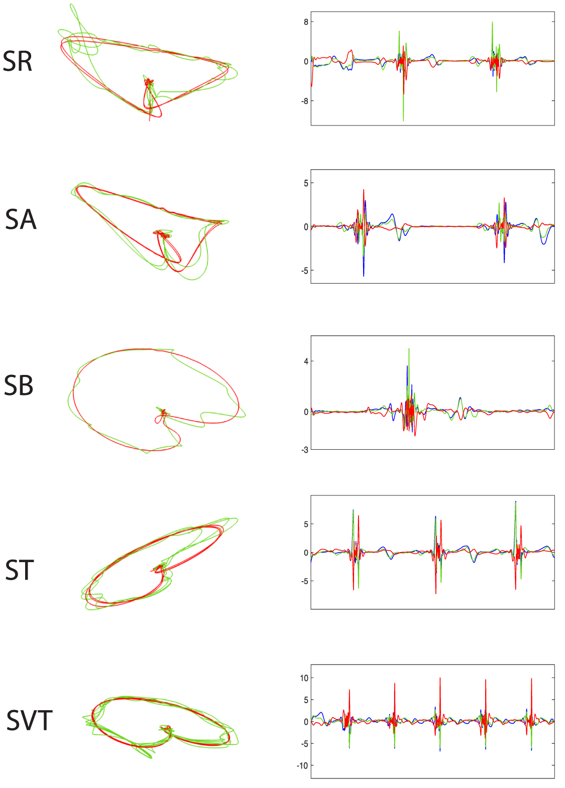 Data-driven dynamics reconstruction using RBF network - IOPscience