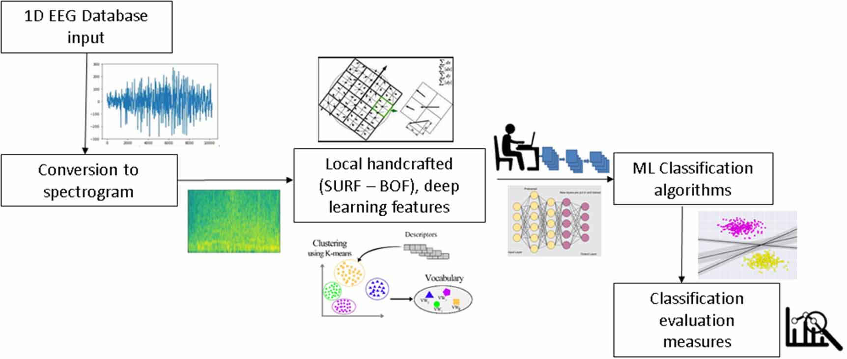 CAD system for epileptic seizure detection from EEG through image ...