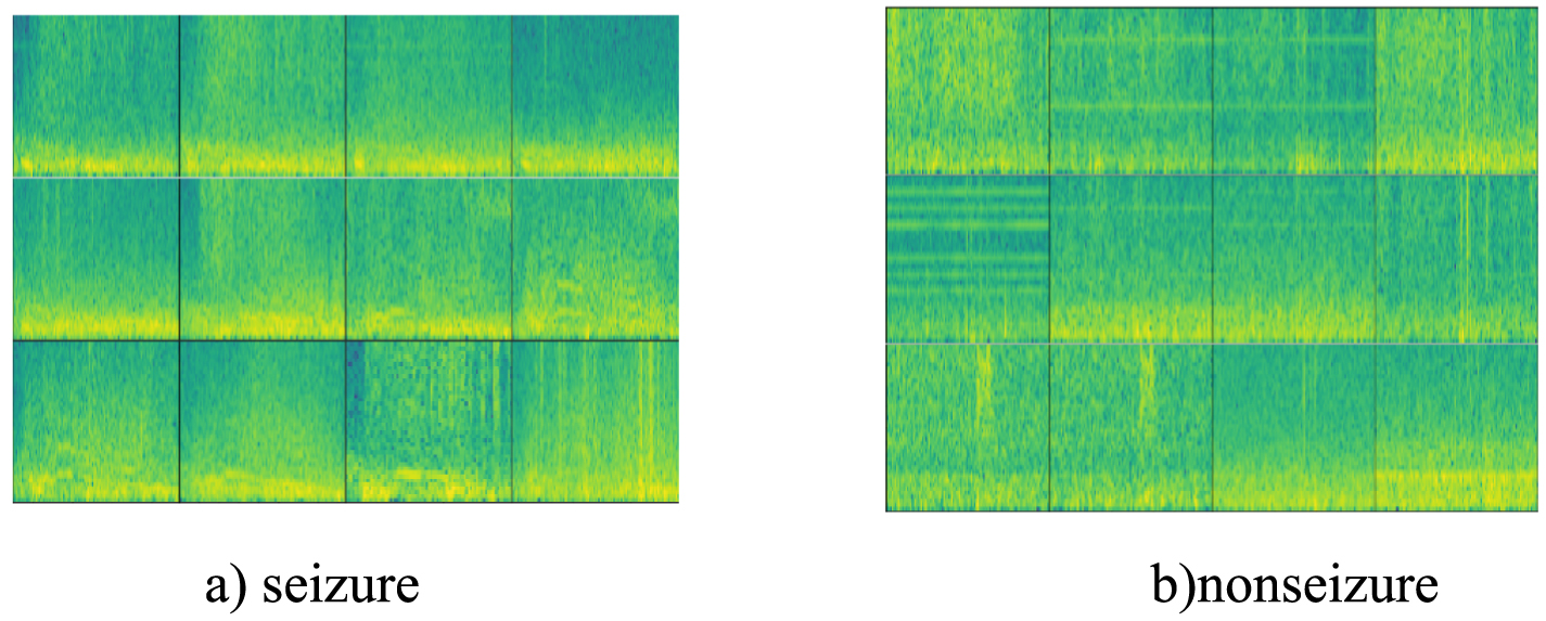 CAD system for epileptic seizure detection from EEG through image ...
