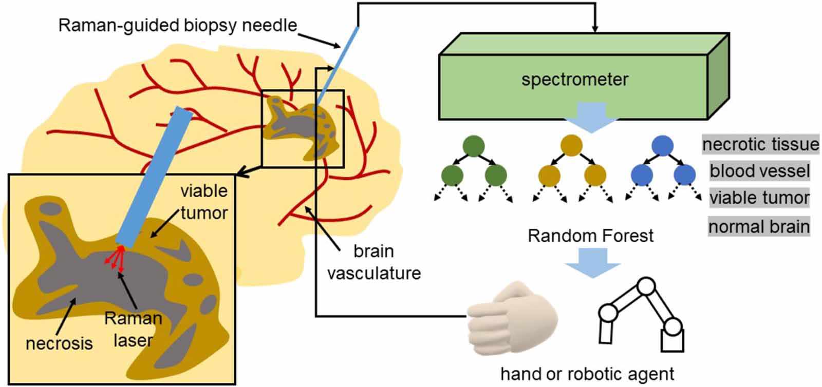 Using random forest for brain tissue identification by Raman ...
