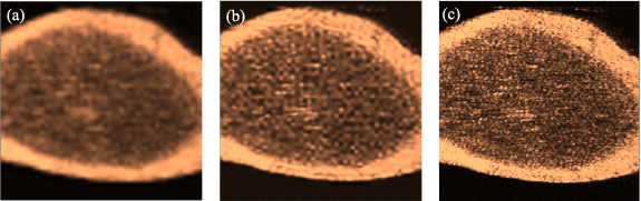 High-resolution imaging in acoustic microscopy using deep learning ...