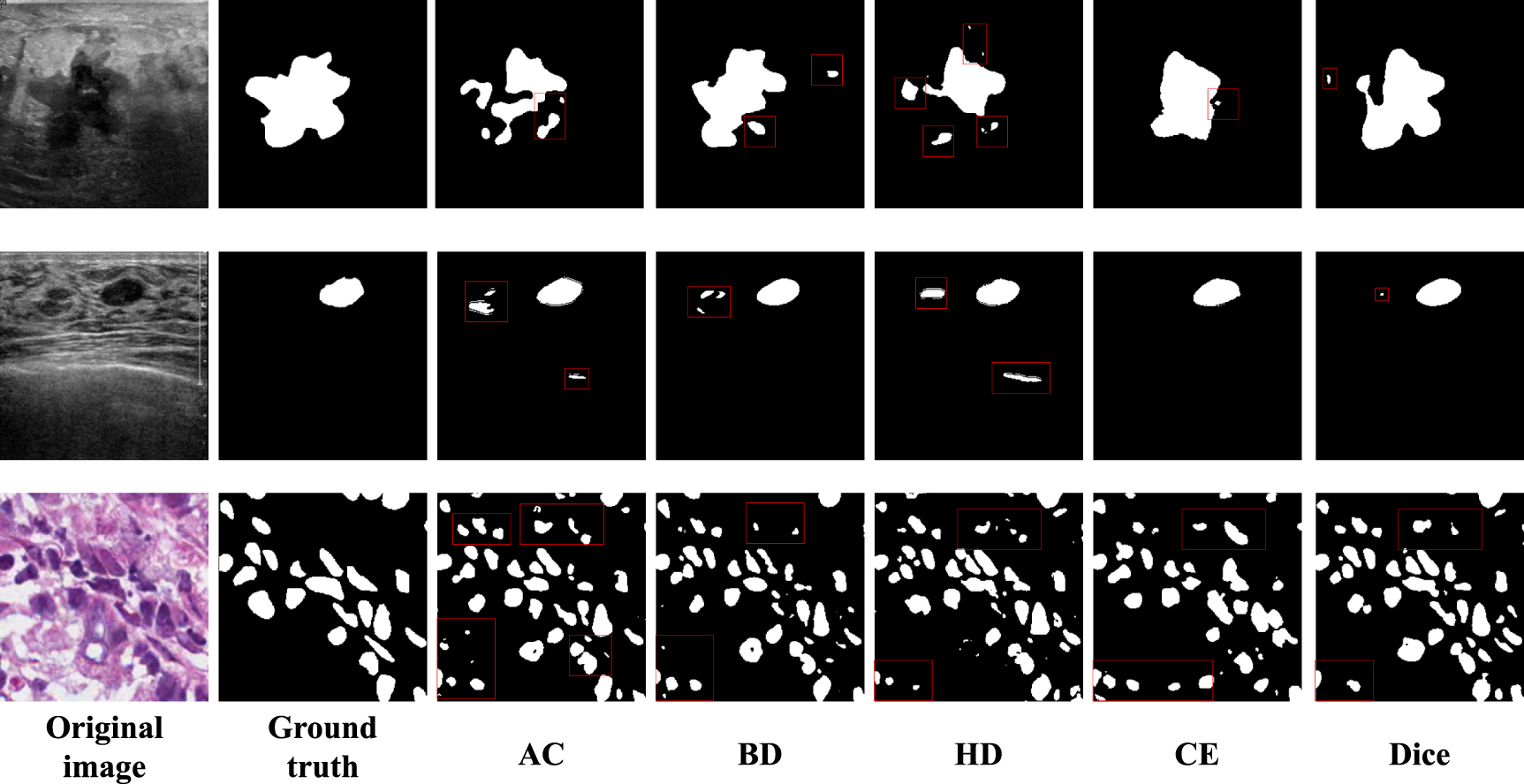 loss for low-contrast medical image segmentation - IOPscience