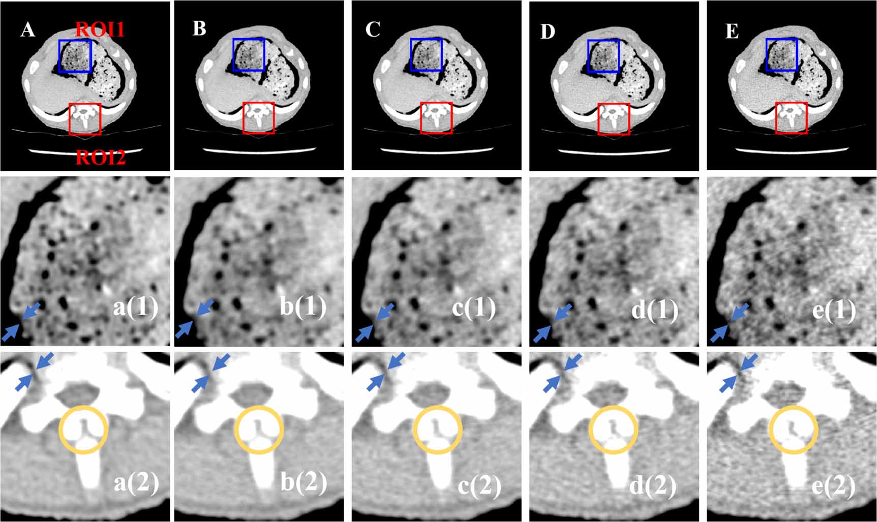Generation model meets swin transformer for unsupervised low-dose CT ...