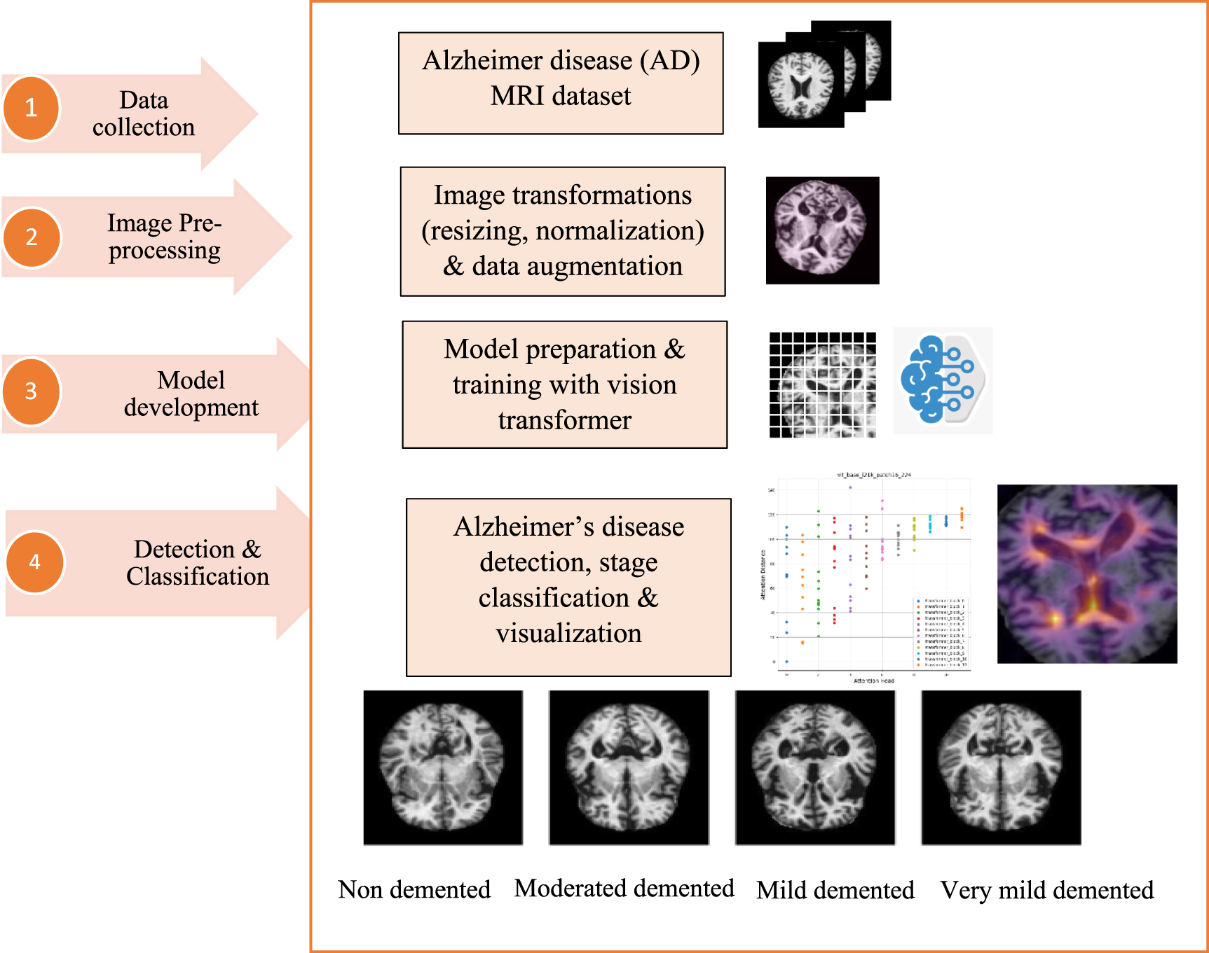 Alzheimer's disease detection and stage identification from magnetic resonance brain images ...