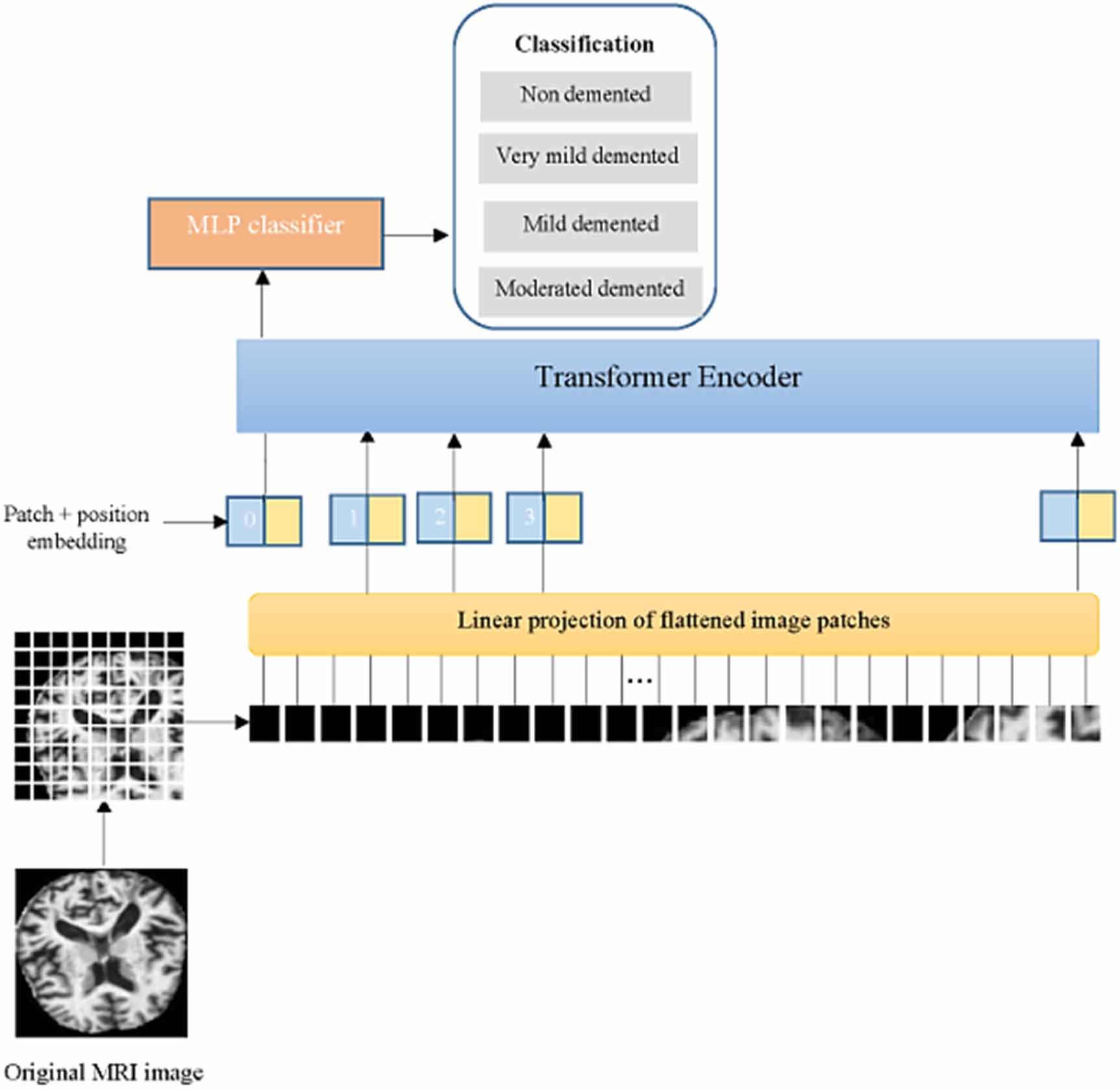 Alzheimer's disease detection and stage identification from magnetic ...