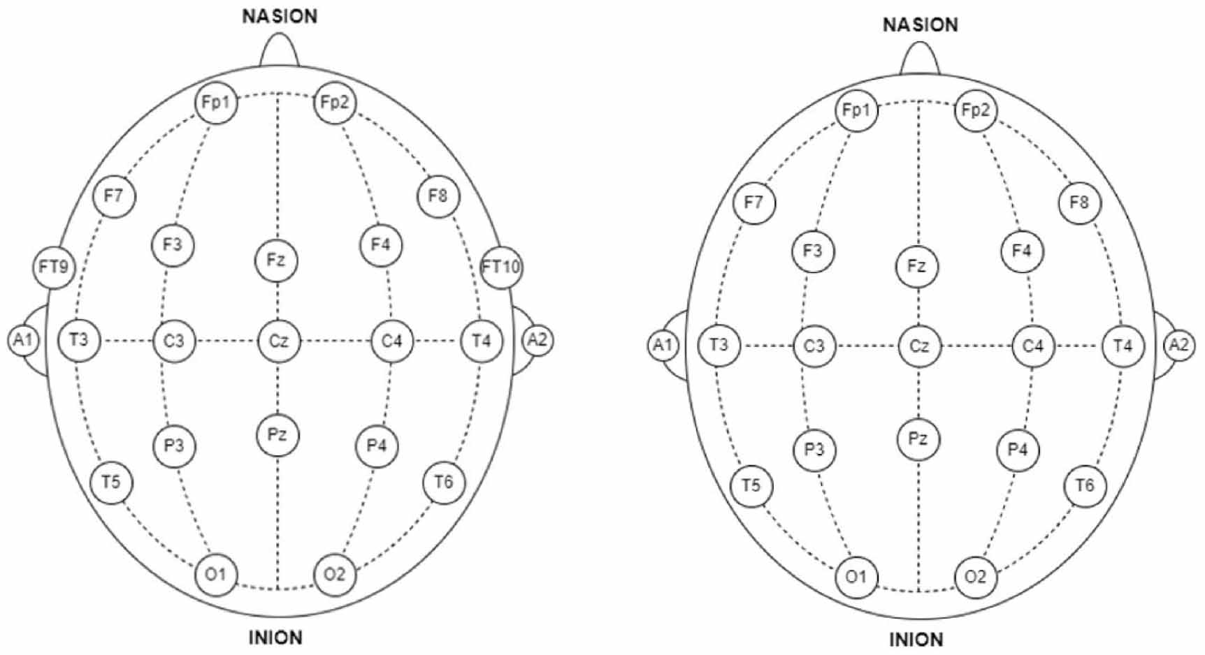 Inception networks, data augmentation and transfer learning in EEG ...