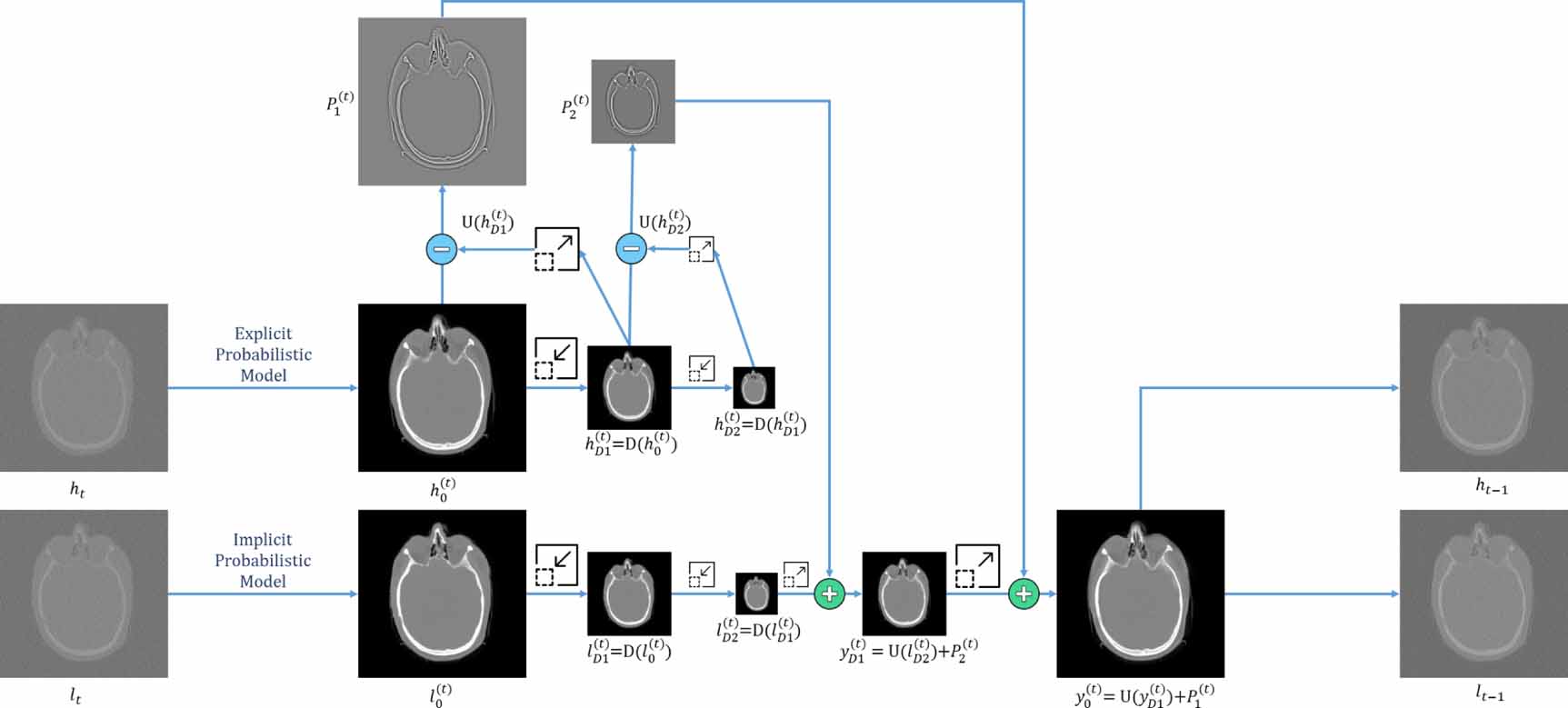 FDDM: unsupervised medical image translation with a frequency-decoupled diffusion model - IOPscience
