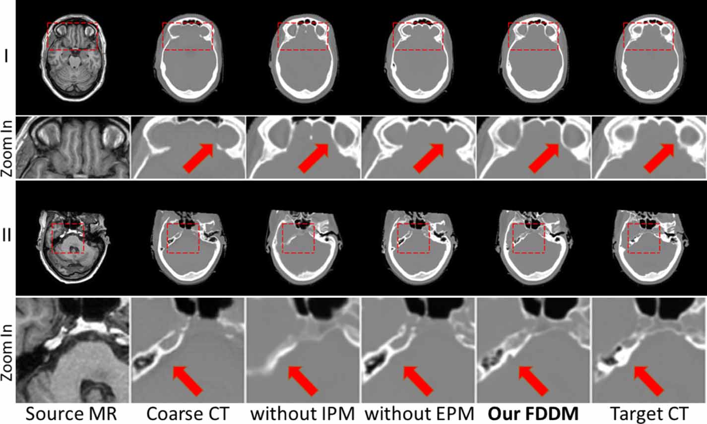 FDDM: unsupervised medical image translation with a frequency-decoupled ...