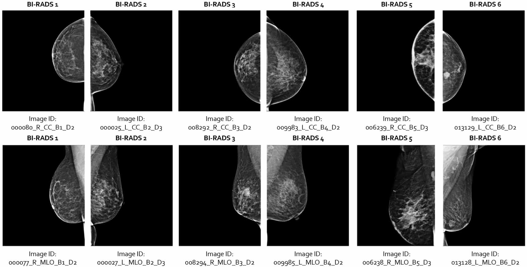 Mammo-MX: an x-ray mammography dataset for computer-aided diagnosis of ...