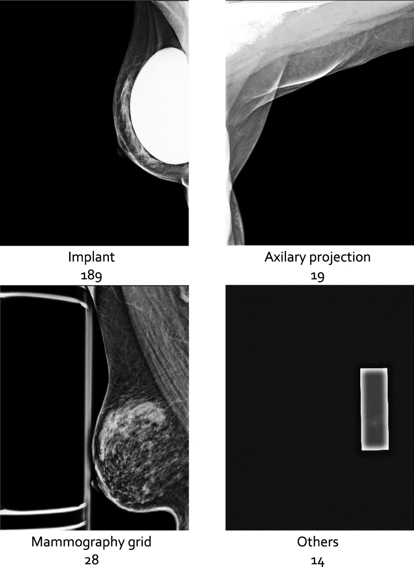Mammo-MX: an x-ray mammography dataset for computer-aided diagnosis of ...