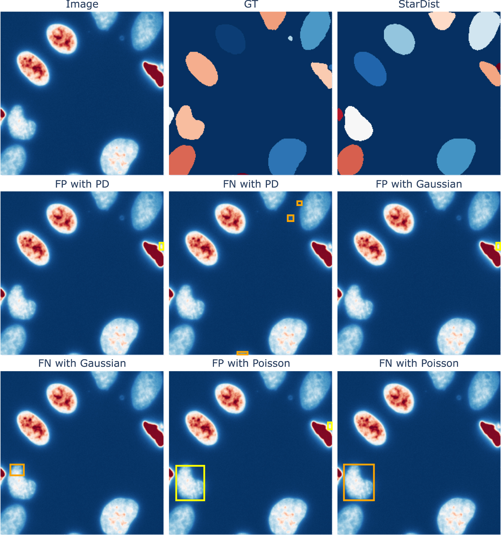 Automated detection of potential artifacts in machine learning based ...