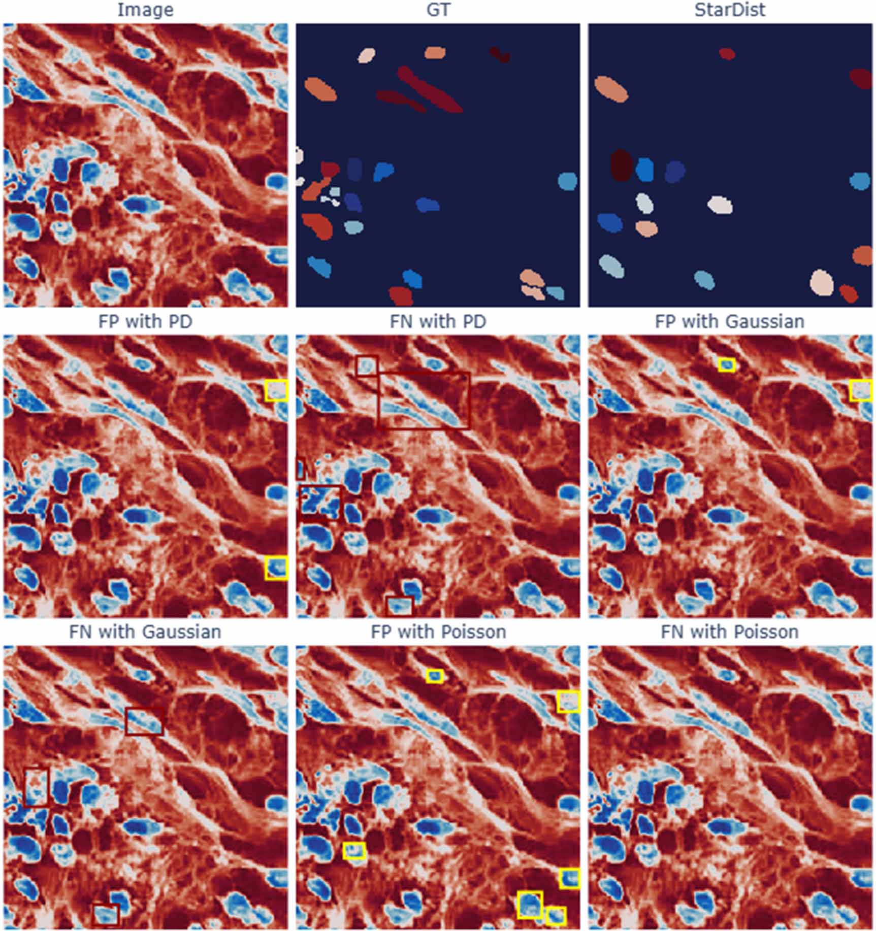 Automated detection of potential artifacts in machine learning based ...