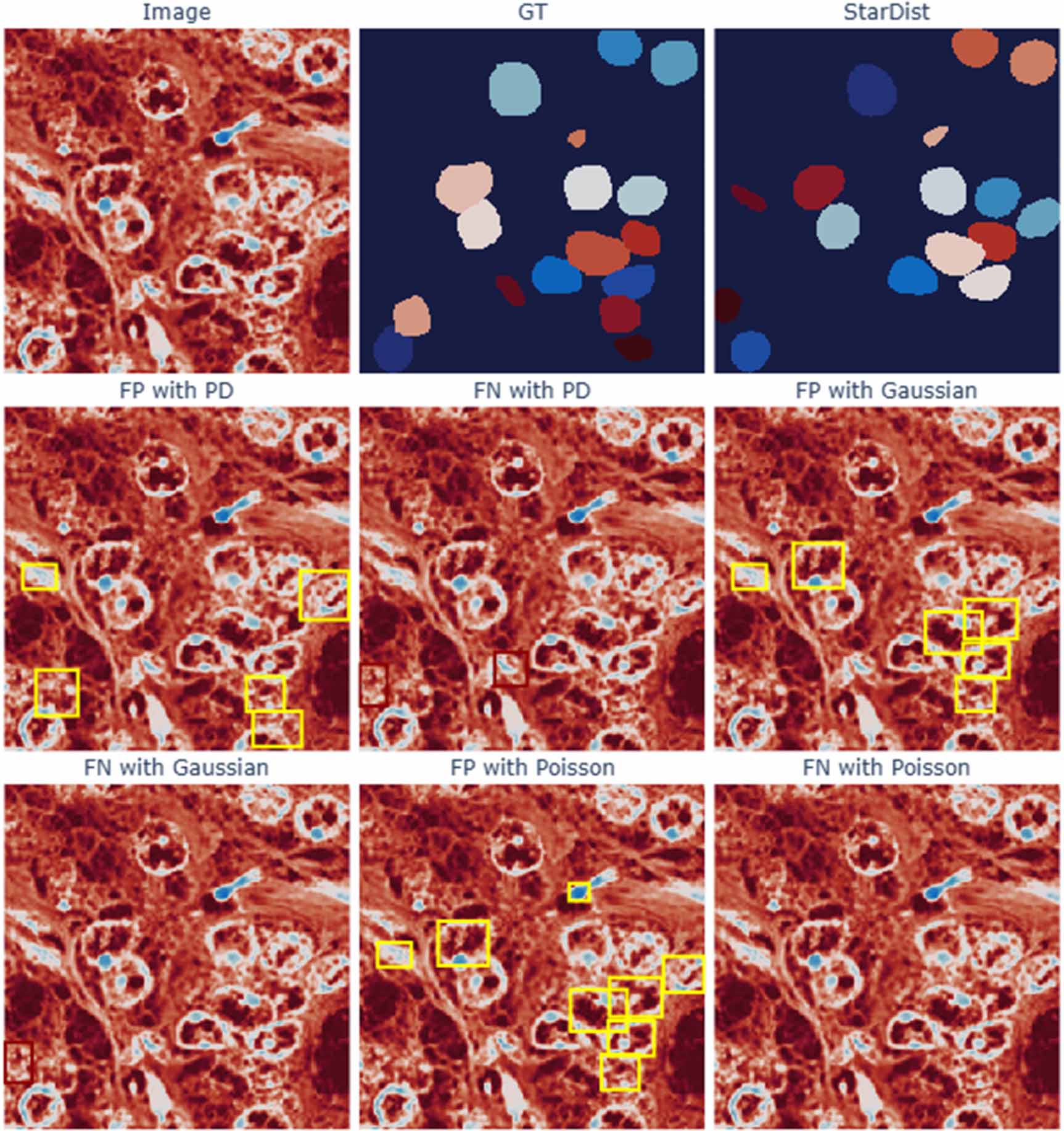 Automated detection of potential artifacts in machine learning based ...