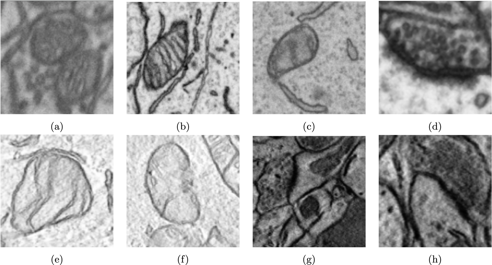 Limited-angle tomography reconstruction via projector guided 3D ...