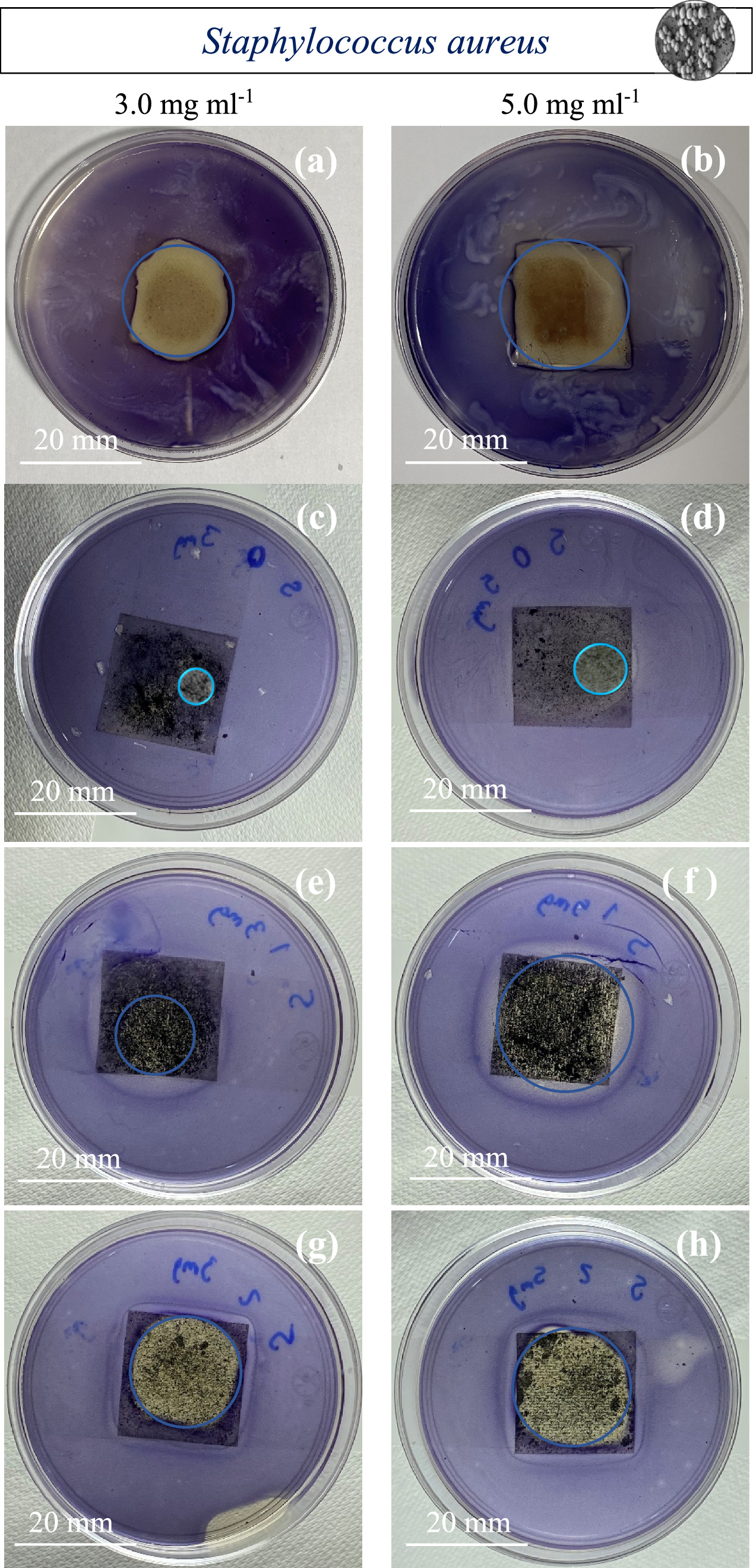 Silver-doped graphite oxide composites used as antimicrobial agents ...