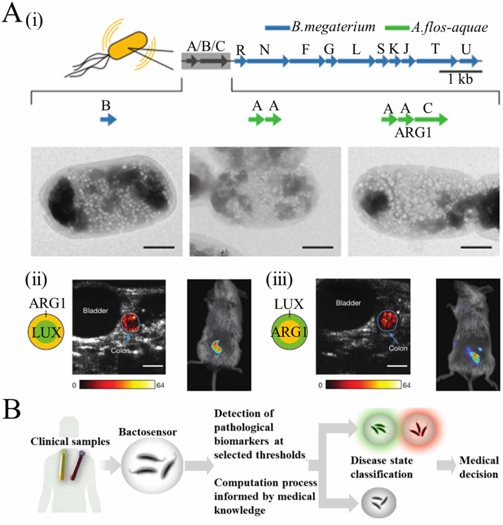 Developing sensor materials for screening intestinal diseases - IOPscience