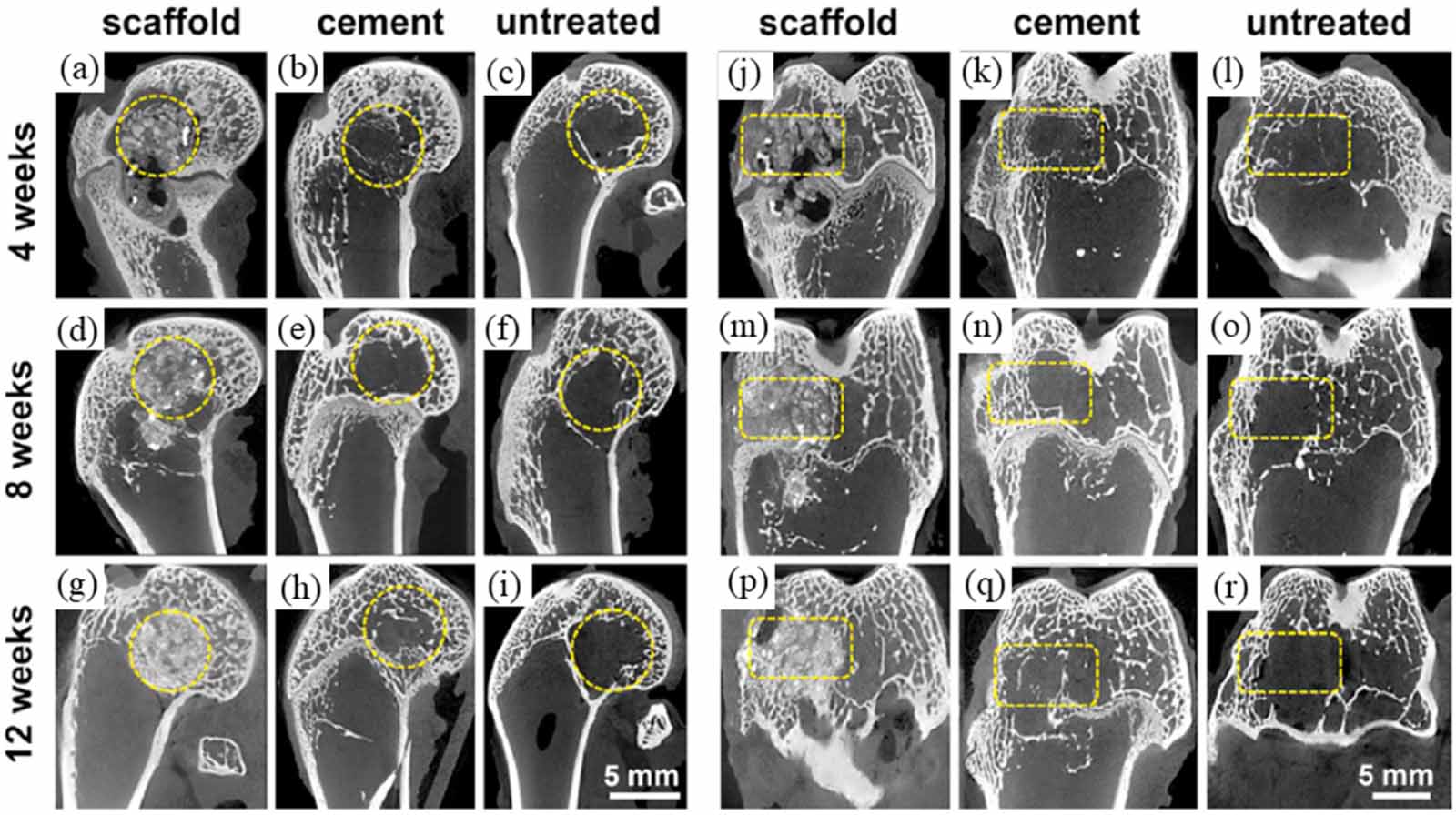 Overview of porous magnesium-based scaffolds: development, properties ...
