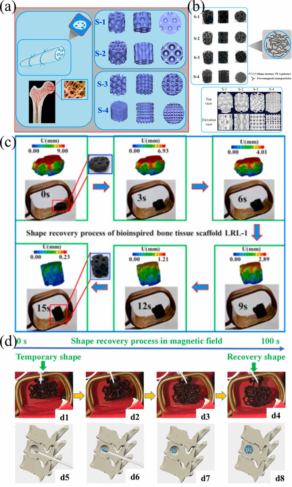 Dynamically customizable 4D printed shape memory polymer biomedical ...
