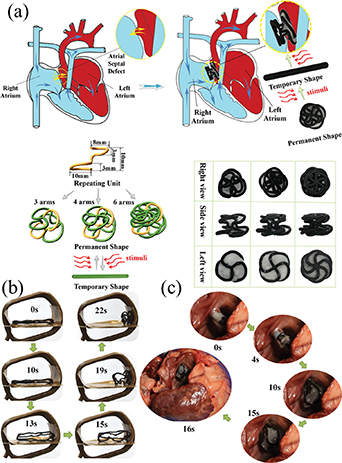 Dynamically customizable 4D printed shape memory polymer biomedical ...