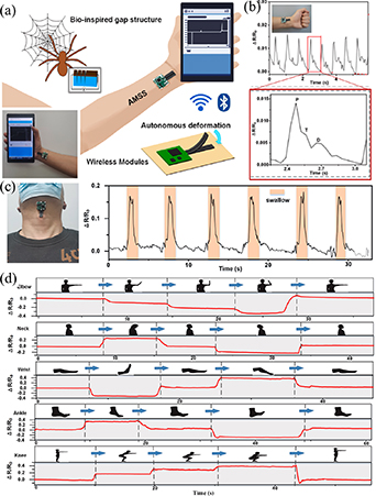 Dynamically customizable 4D printed shape memory polymer biomedical ...