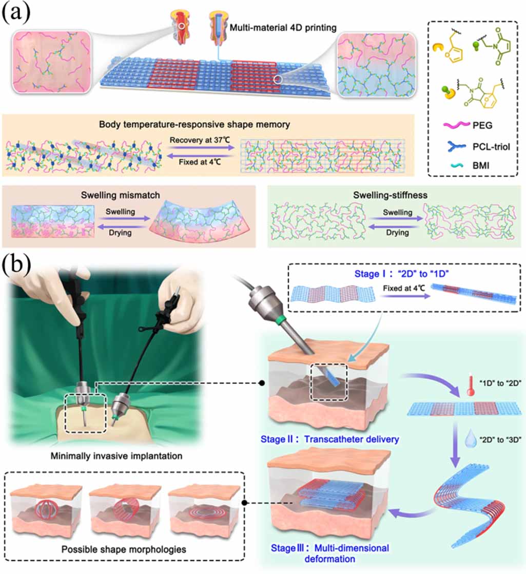 Dynamically customizable 4D printed shape memory polymer biomedical ...